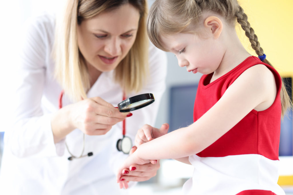 Doctor examining pigmented nevus on little girls hand with magnifying ...